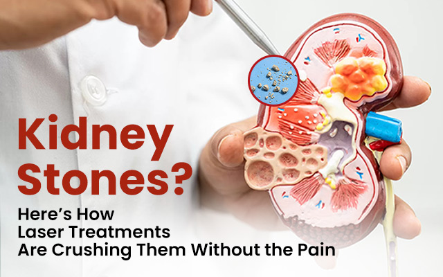Kidney Stones? Here’s How Laser Treatments Are Crushing Them Without ...